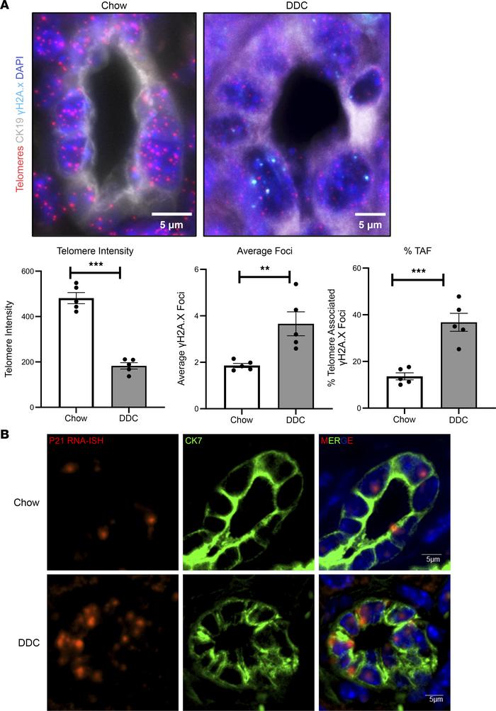 JCI Insight - Telomere dysfunction promotes cholangiocyte senescence ...