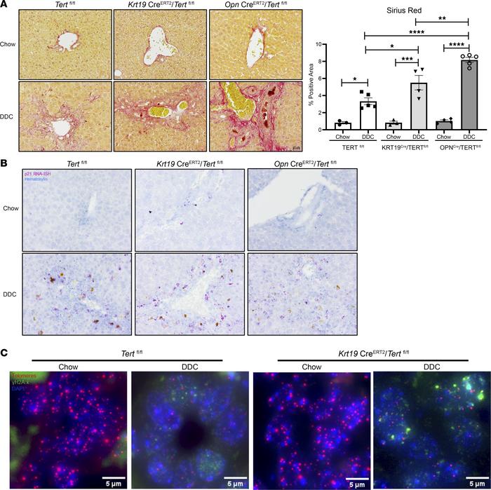 Jci Insight Telomere Dysfunction Promotes Cholangiocyte Senescence And Biliary Fibrosis In