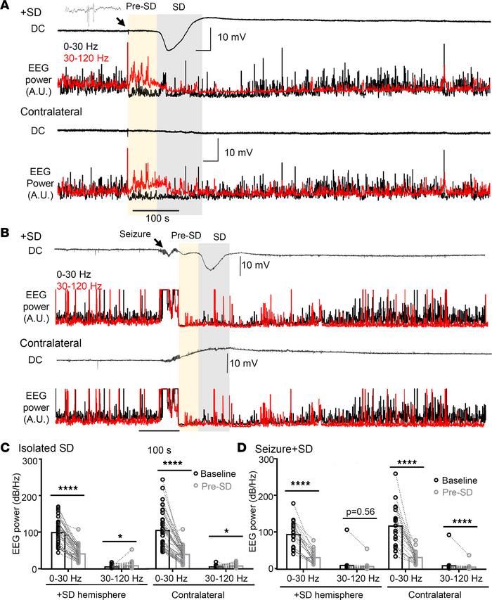 JCI Insight - A hyperthermic seizure unleashes a surge of spreading ...