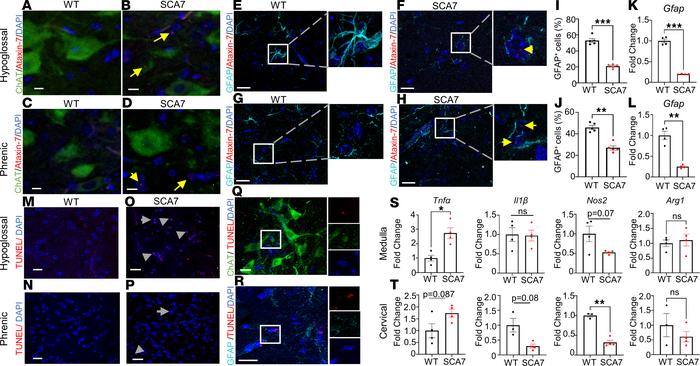 JCI Insight - Respiratory neuropathology in spinocerebellar ataxia type 7