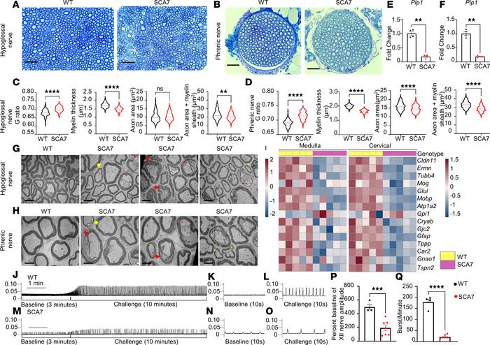 JCI Insight - Respiratory neuropathology in spinocerebellar ataxia type 7
