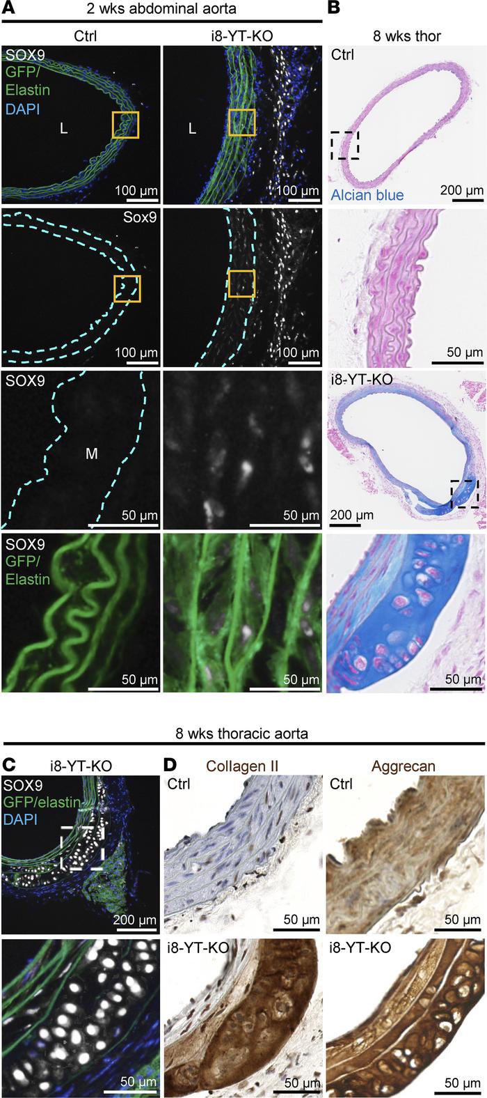 JCI Insight - Vascular smooth muscle–specific YAP/TAZ deletion triggers ...