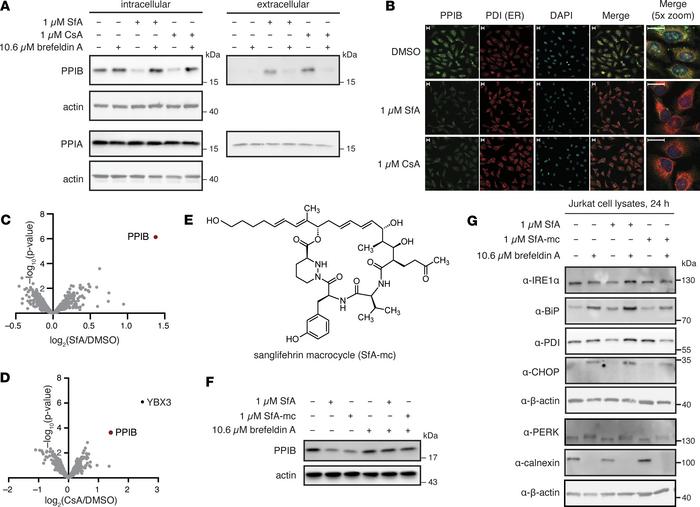 JCI Insight - Sanglifehrin A mitigates multiorgan fibrosis by targeting ...