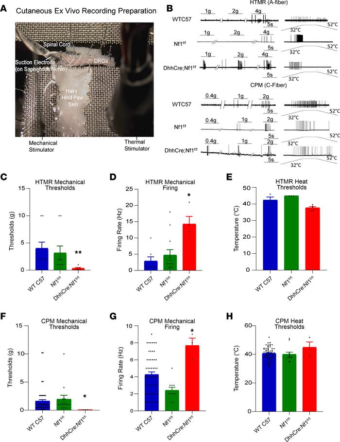 JCI Insight - Schwann cells modulate nociception in neurofibromatosis 1