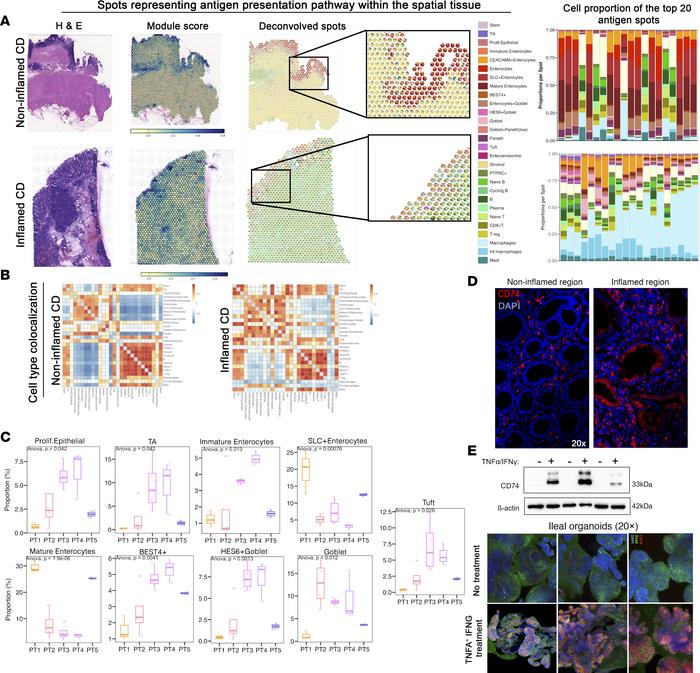 JCI Insight - Altered inflammatory mucosal signatures within their ...