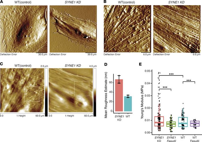 JCI Insight - Exome sequencing implicates ancestry-related Mendelian ...