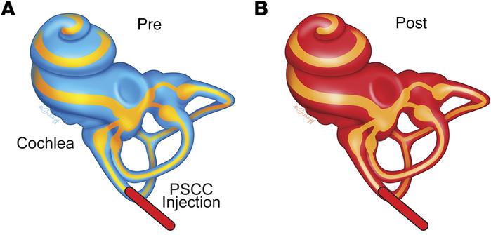 JCI Insight - Semicircular canal drug delivery safely targets the inner ...
