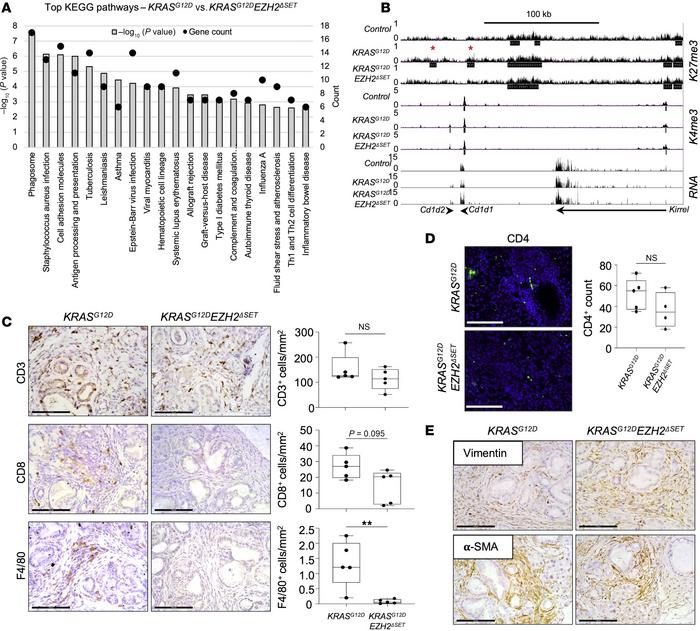 JCI Insight - EZH2 deletion does not affect acinar regeneration but ...