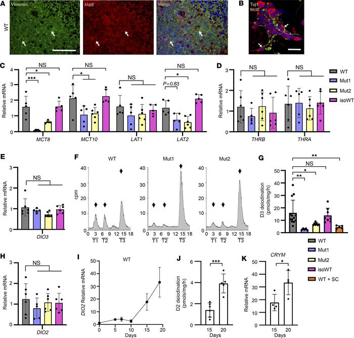 JCI Insight - Impaired T3 uptake and action in MCT8-deficient cerebral ...