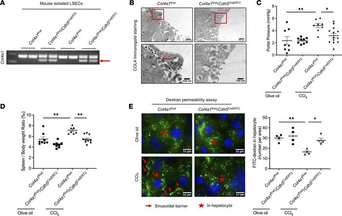JCI Insight - Liver sinusoidal endothelial cells contribute to portal ...