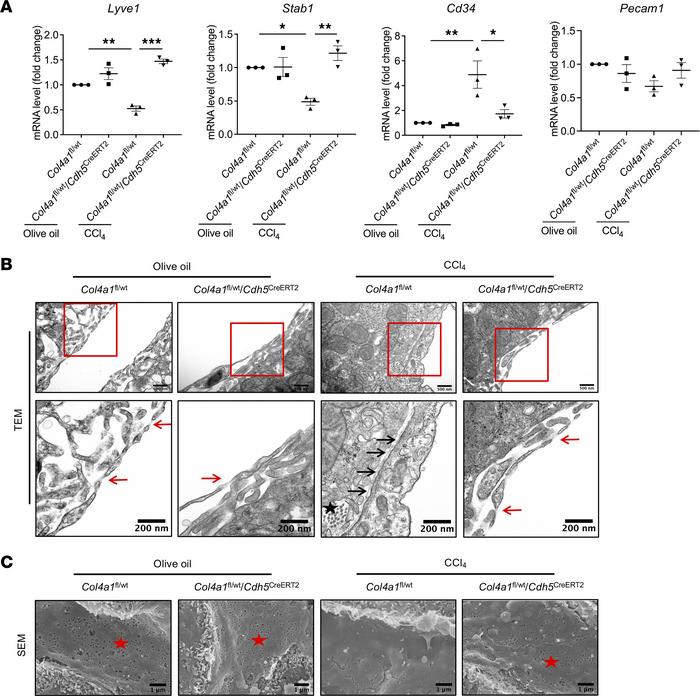 JCI Insight - Liver sinusoidal endothelial cells contribute to portal ...