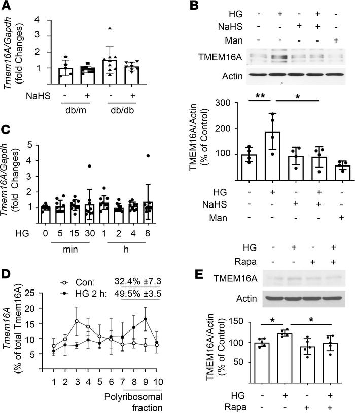 JCI Insight - The CLCA1/TMEM16A/Cl– current axis associates with H2S ...