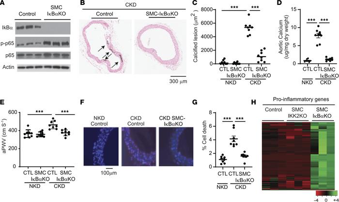 JCI Insight - Activation of the IKK2/NF-κB pathway in VSMCs inhibits ...