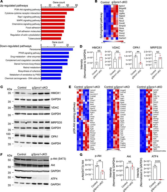 JCI Insight - Lack of SPNS1 results in accumulation of lysolipids and ...