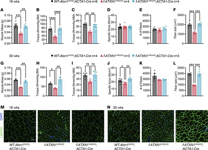 JCI Insight - Mapping SCA1 regional vulnerabilities reveals neural and ...