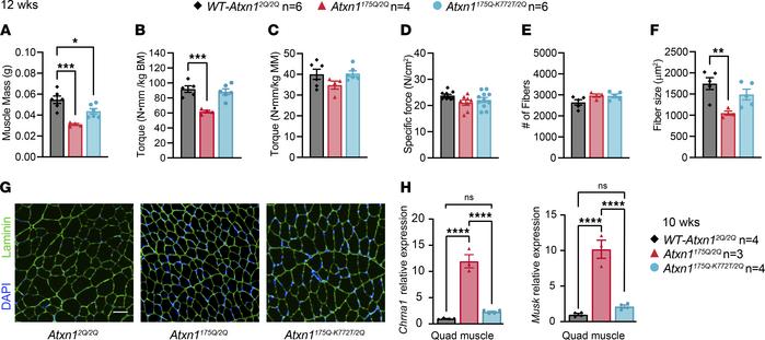 JCI Insight - Mapping SCA1 regional vulnerabilities reveals neural and ...