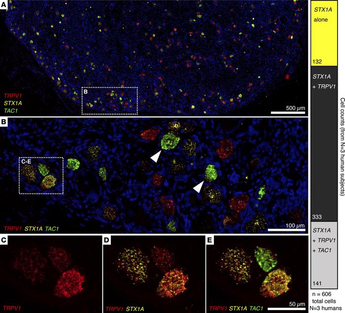 JCI Insight - Syntaxin1A overexpression and pain insensitivity in ...