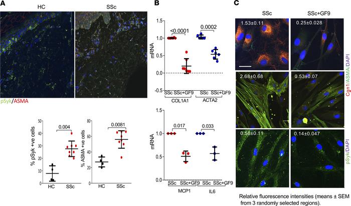 JCI Insight - Inhibiting triggering receptor expressed on myeloid cells ...