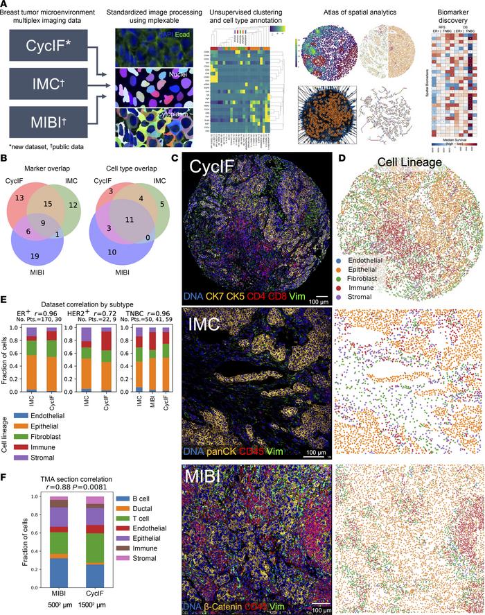 JCI Insight - Highly multiplexed imaging reveals prognostic immune and stromal spatial ...