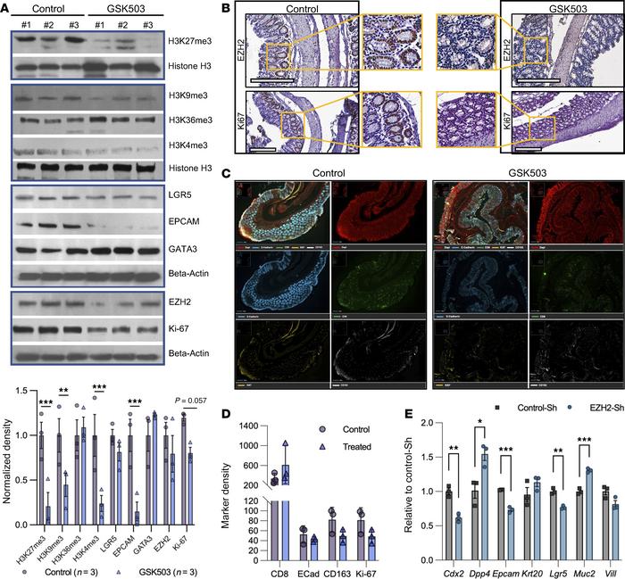 JCI Insight - Inhibition of histone methyltransferase EZH2 for immune interception of colorectal ...