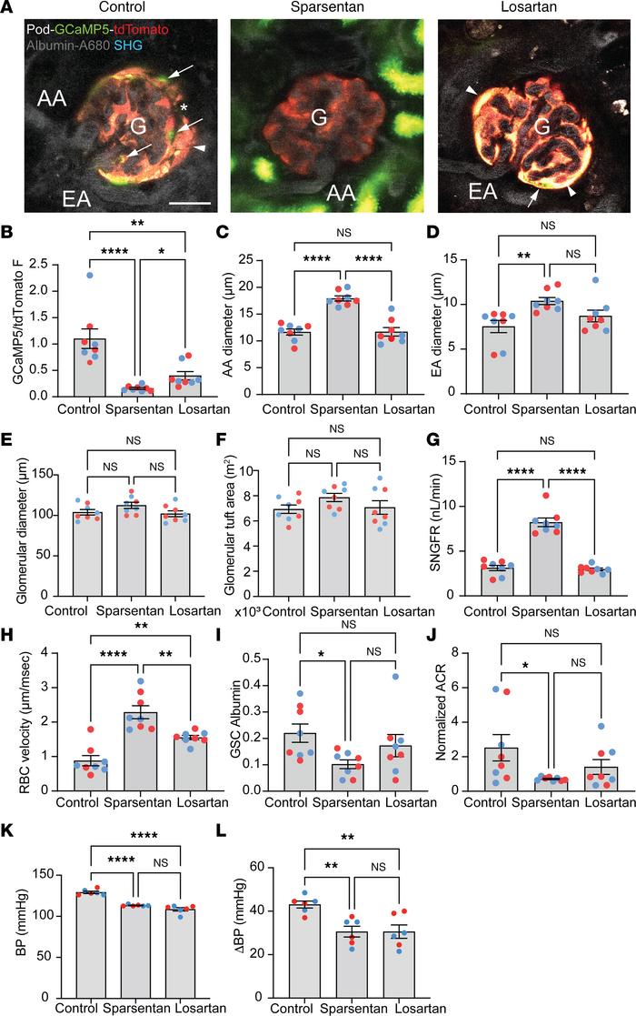 JCI Insight - Sparsentan improves glomerular hemodynamics, cell ...