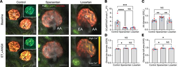 JCI Insight - Sparsentan improves glomerular hemodynamics, cell ...