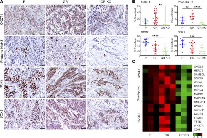 JCI Insight - Targeting ketone body metabolism in mitigating ...
