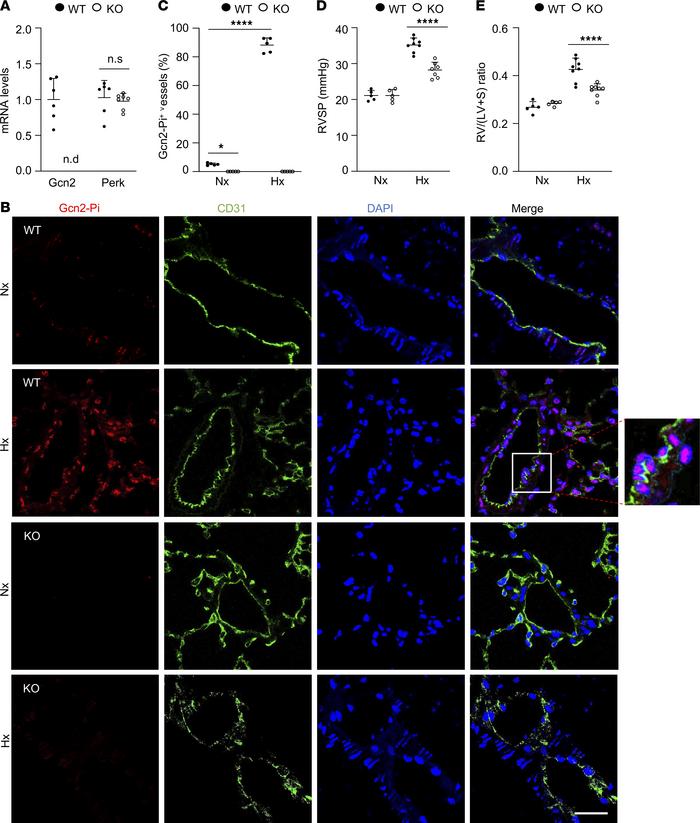 JCI Insight - GCN2 kinase activation mediates pulmonary vascular ...