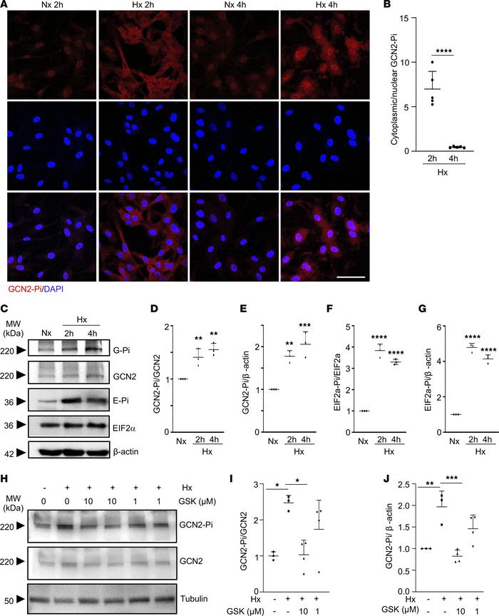 JCI Insight - GCN2 kinase activation mediates pulmonary vascular ...