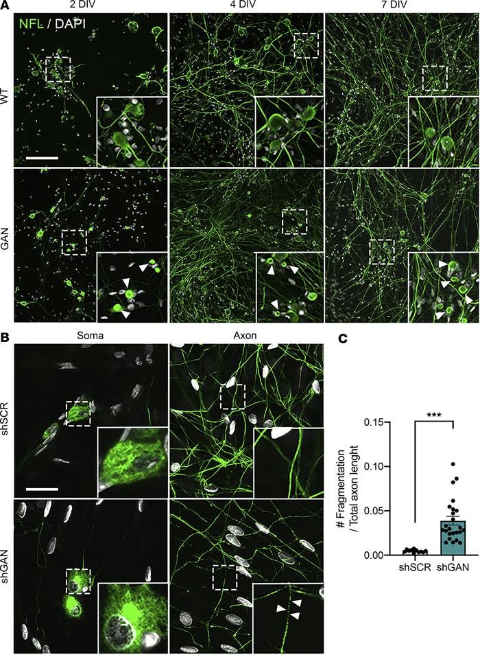 JCI Insight - Neurofilament accumulation disrupts autophagy in giant ...