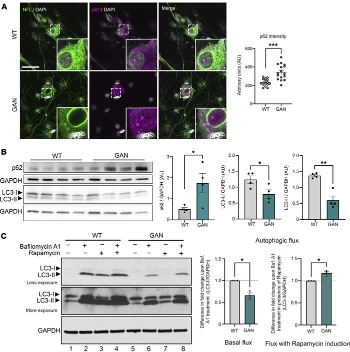 JCI Insight - Neurofilament accumulation disrupts autophagy in giant ...
