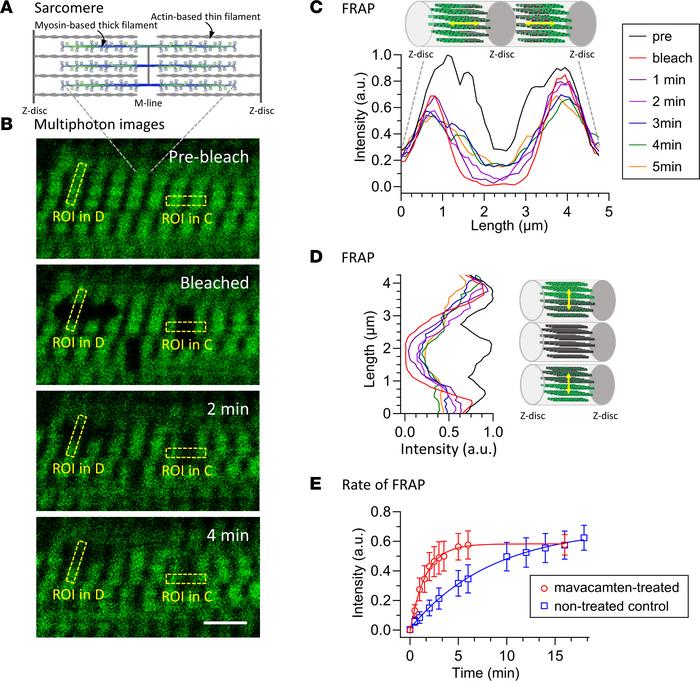 JCI Insight - Myosin folding boosts solubility in cardiac muscle sarcomeres