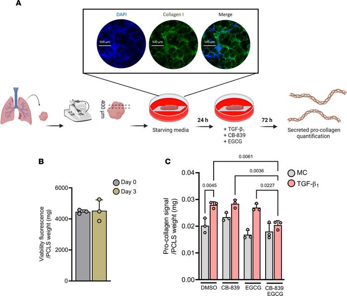 JCI Insight - Pyruvate metabolism dictates fibroblast sensitivity to ...