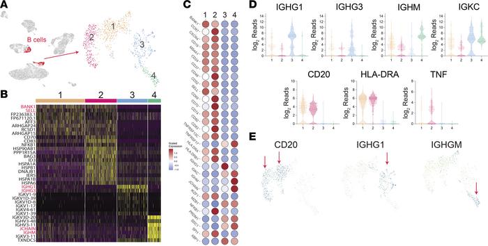 JCI Insight - SPP1hi macrophages, NKG7 T cells, CCL5hi fibroblasts, and ...