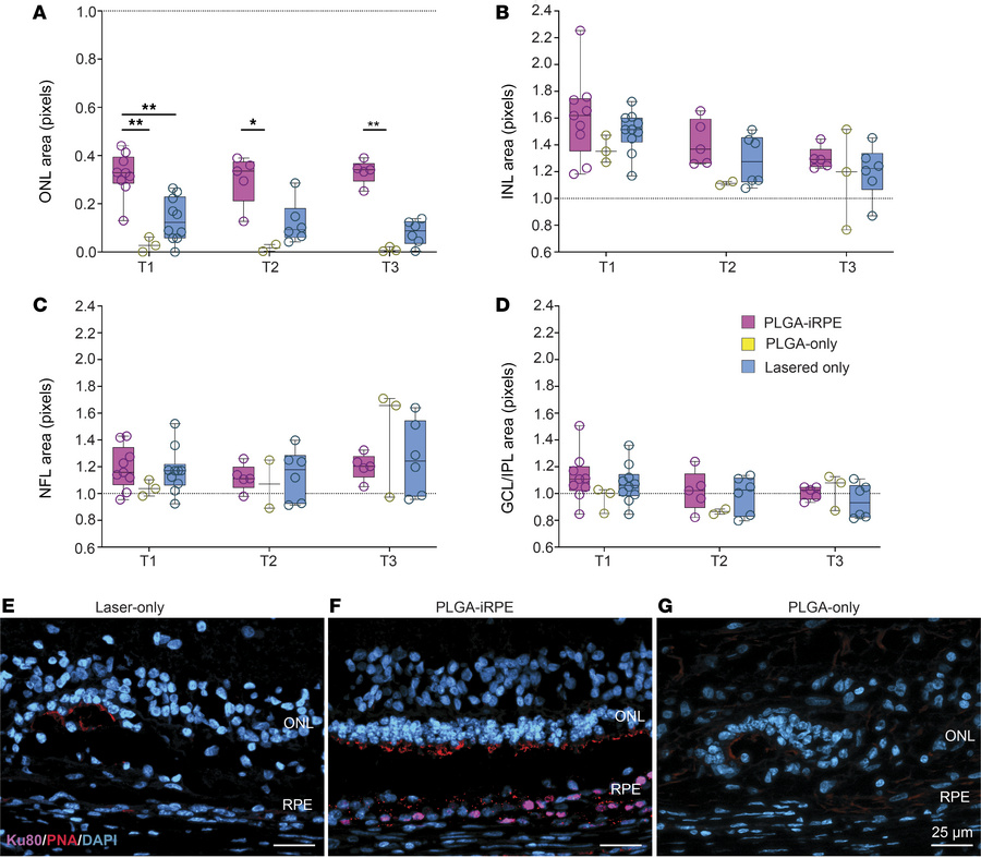 JCI Insight - iPSC-RPE patch restores photoreceptors and regenerates ...