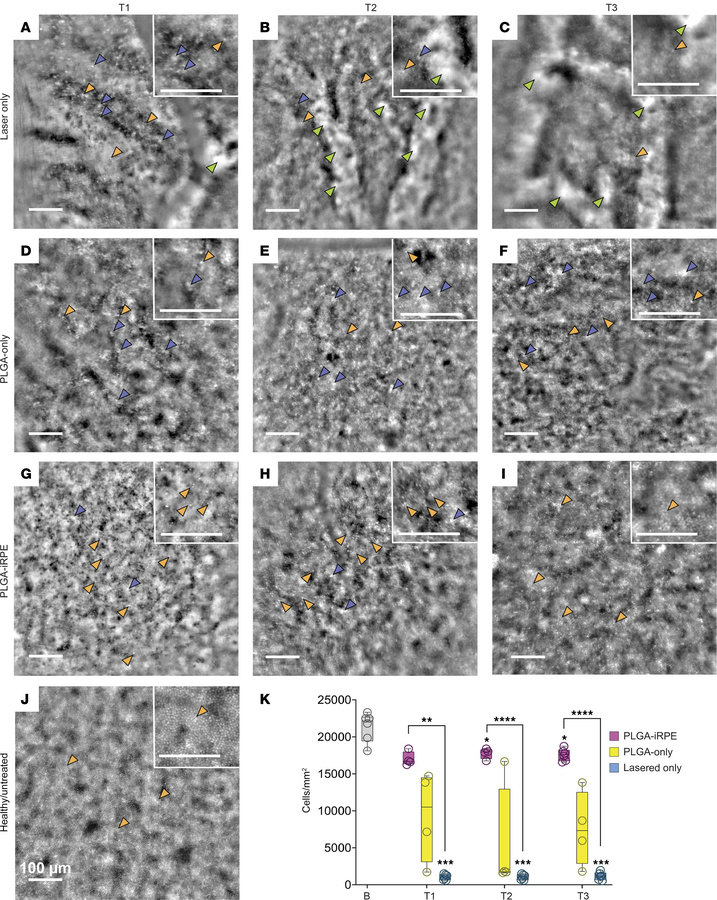 JCI Insight - iPSC-RPE patch restores photoreceptors and regenerates ...