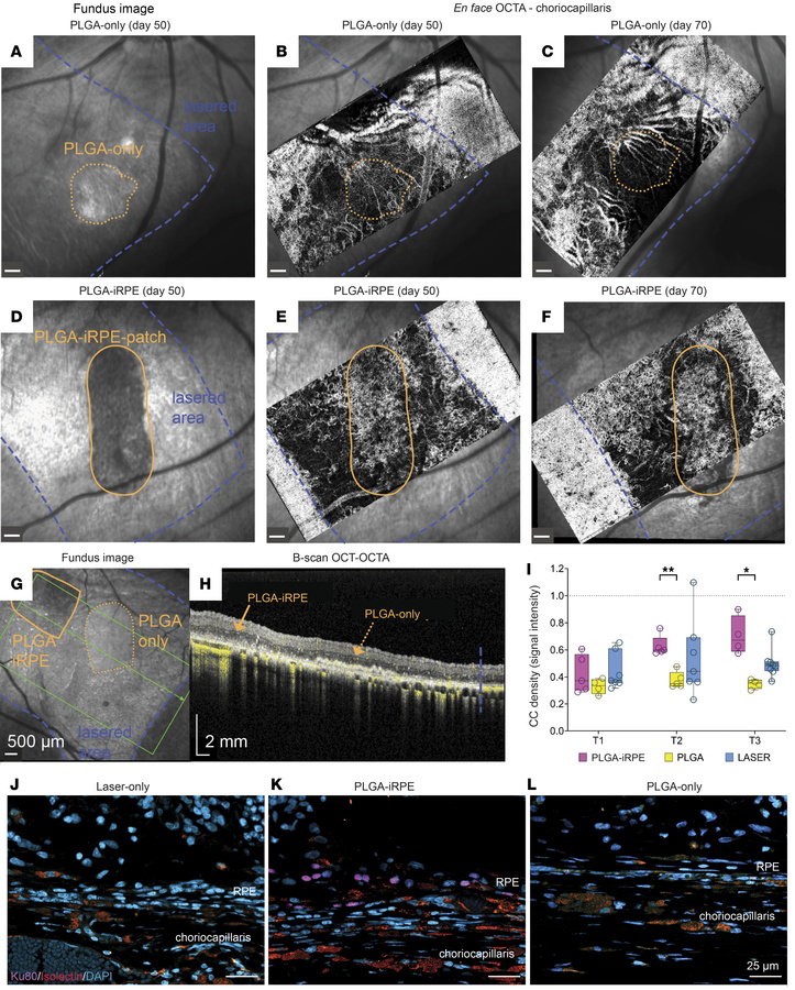 JCI Insight - iPSC-RPE patch restores photoreceptors and regenerates ...