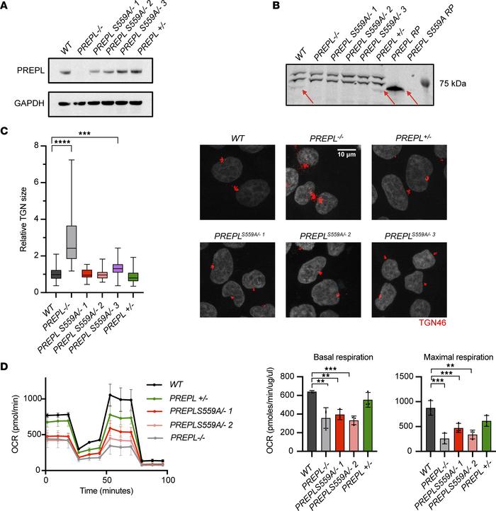 JCI Insight - Missense variants in CMS22 patients reveal that PREPL has ...
