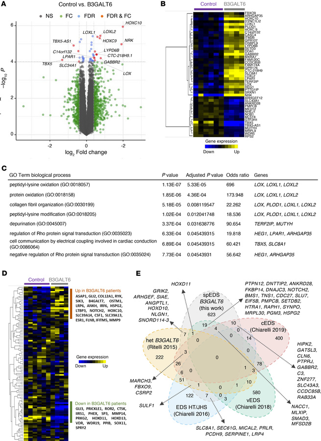 JCI Insight - B3GALT6 mutations lead to compromised connective tissue ...