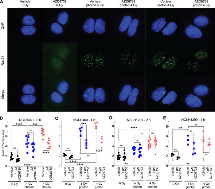 JCI Insight - ATR inhibition radiosensitizes cells through augmented ...