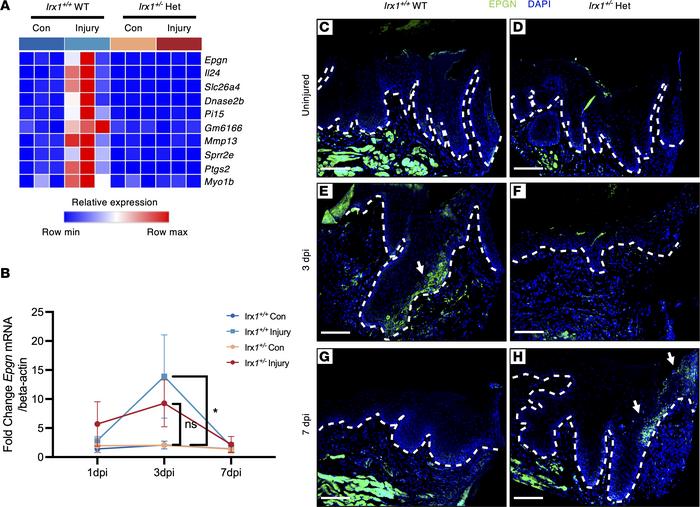 JCI Insight - Irx1 mechanisms for oral epithelial basal stem cell ...