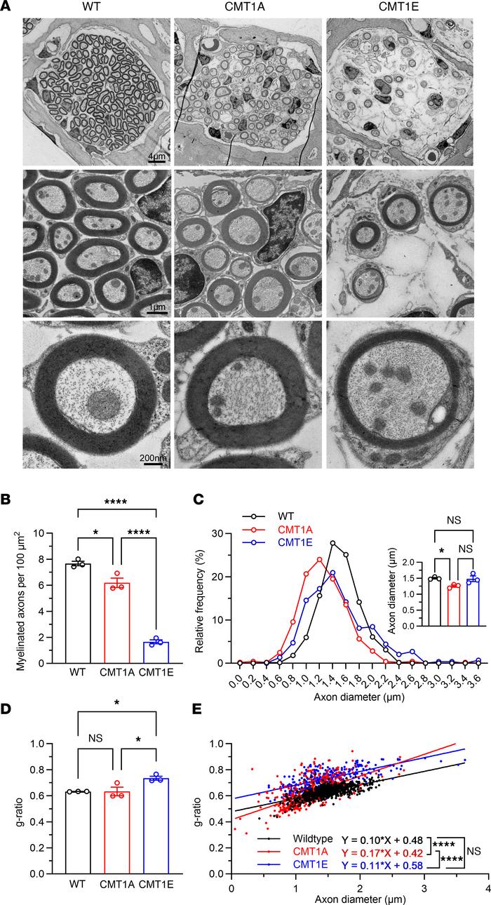 JCI Insight - Hidden hearing loss in a Charcot-Marie-Tooth type 1A ...