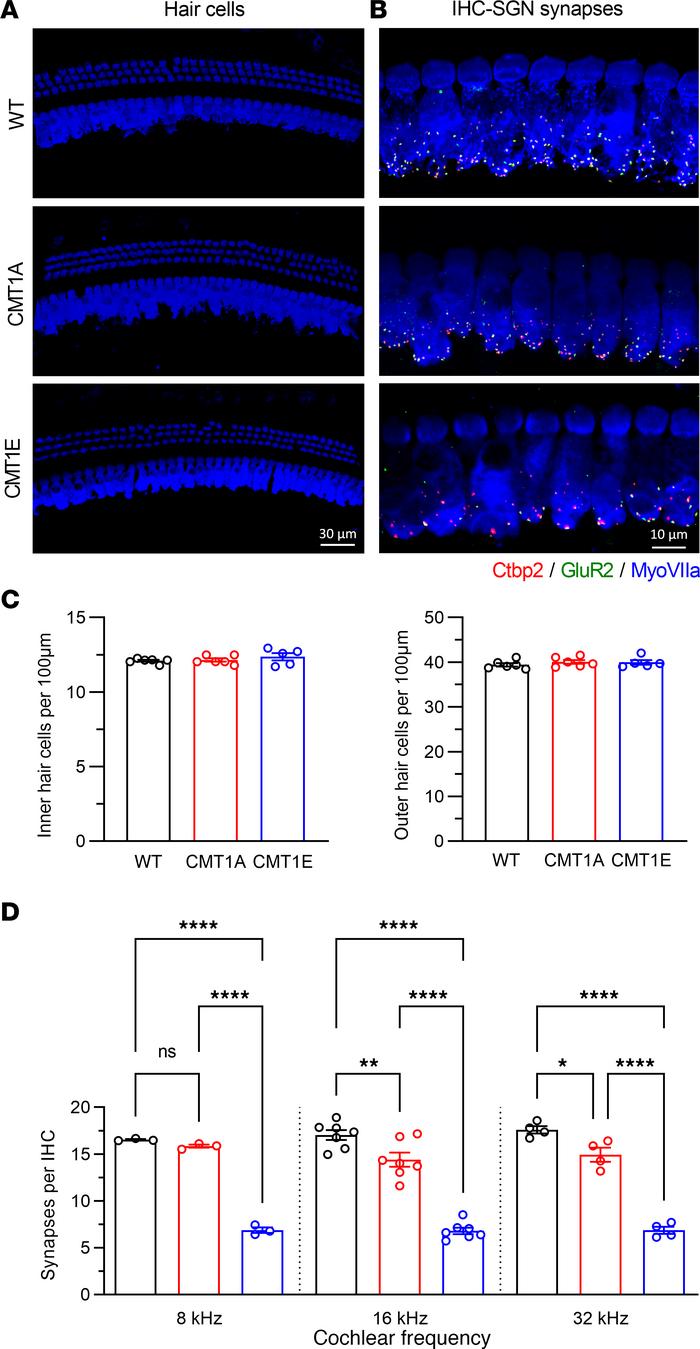 JCI Insight - Hidden hearing loss in a Charcot-Marie-Tooth type 1A ...