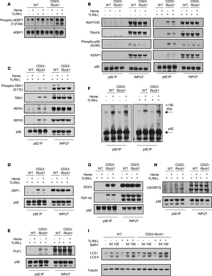 JCI Insight - ROCK1 promotes B cell differentiation and proteostasis ...