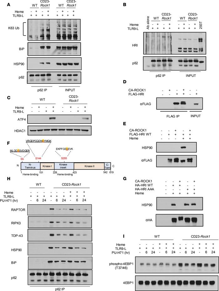 JCI Insight - ROCK1 promotes B cell differentiation and proteostasis ...