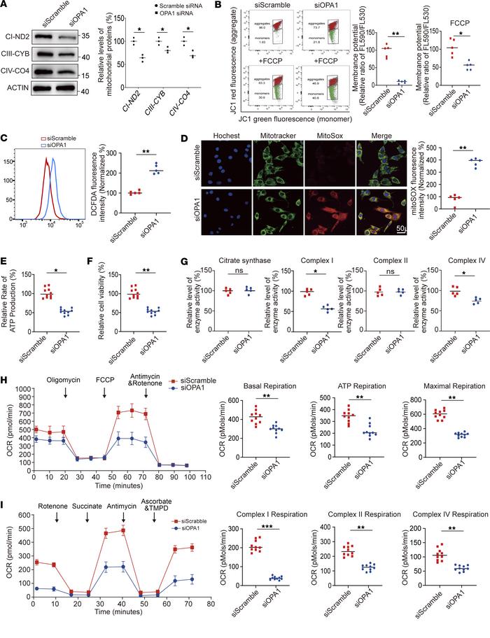 JCI Insight - Targeting DRP1 with Mdivi-1 to correct mitochondrial ...