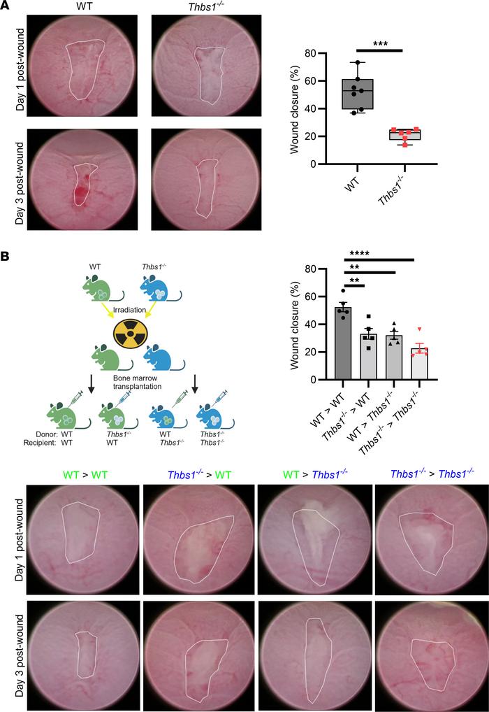 JCI Insight - Critical role of thrombospondin-1 in promoting intestinal ...