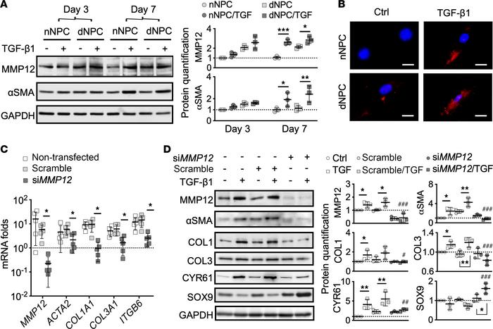 JCI Insight - MMP12-dependent myofibroblast formation contributes to ...