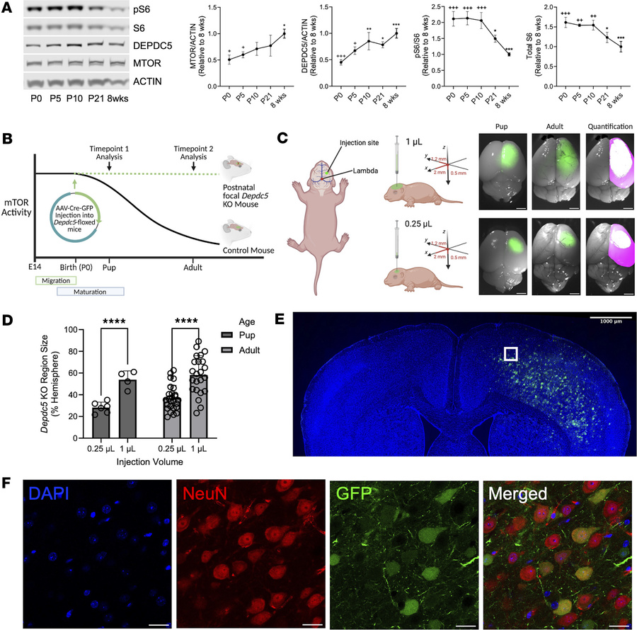 JCI Insight - Focal DEPDC5 loss without disruption to cerebral cortical ...