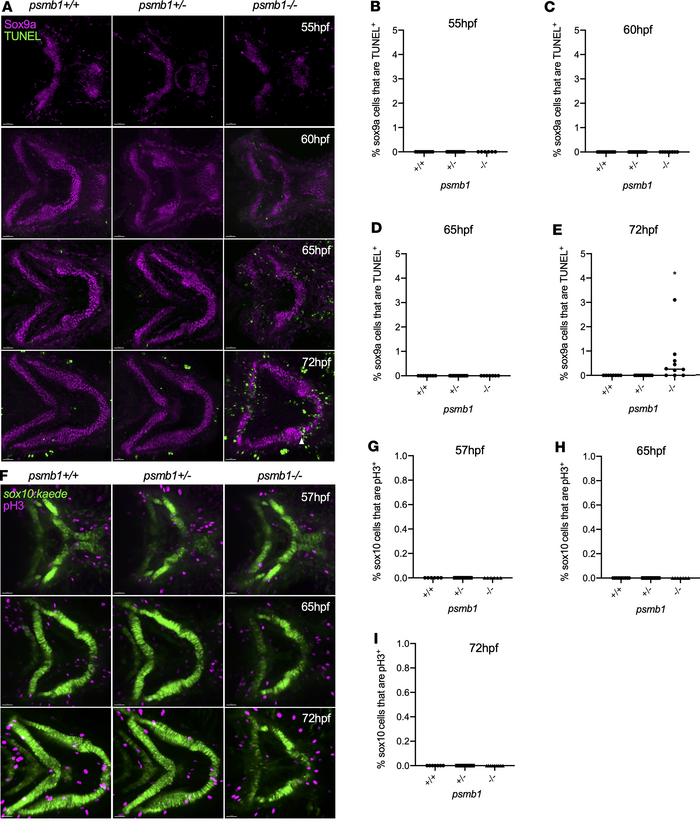 JCI Insight - The proteasome subunit psmb1 is essential for ...